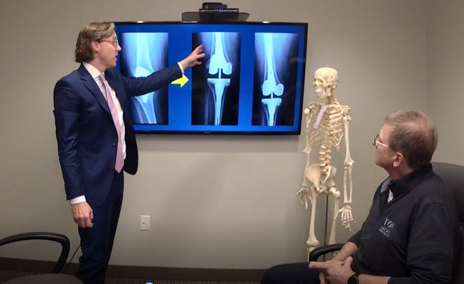 "The Doctor Is In" - Knee Revisions | TOA